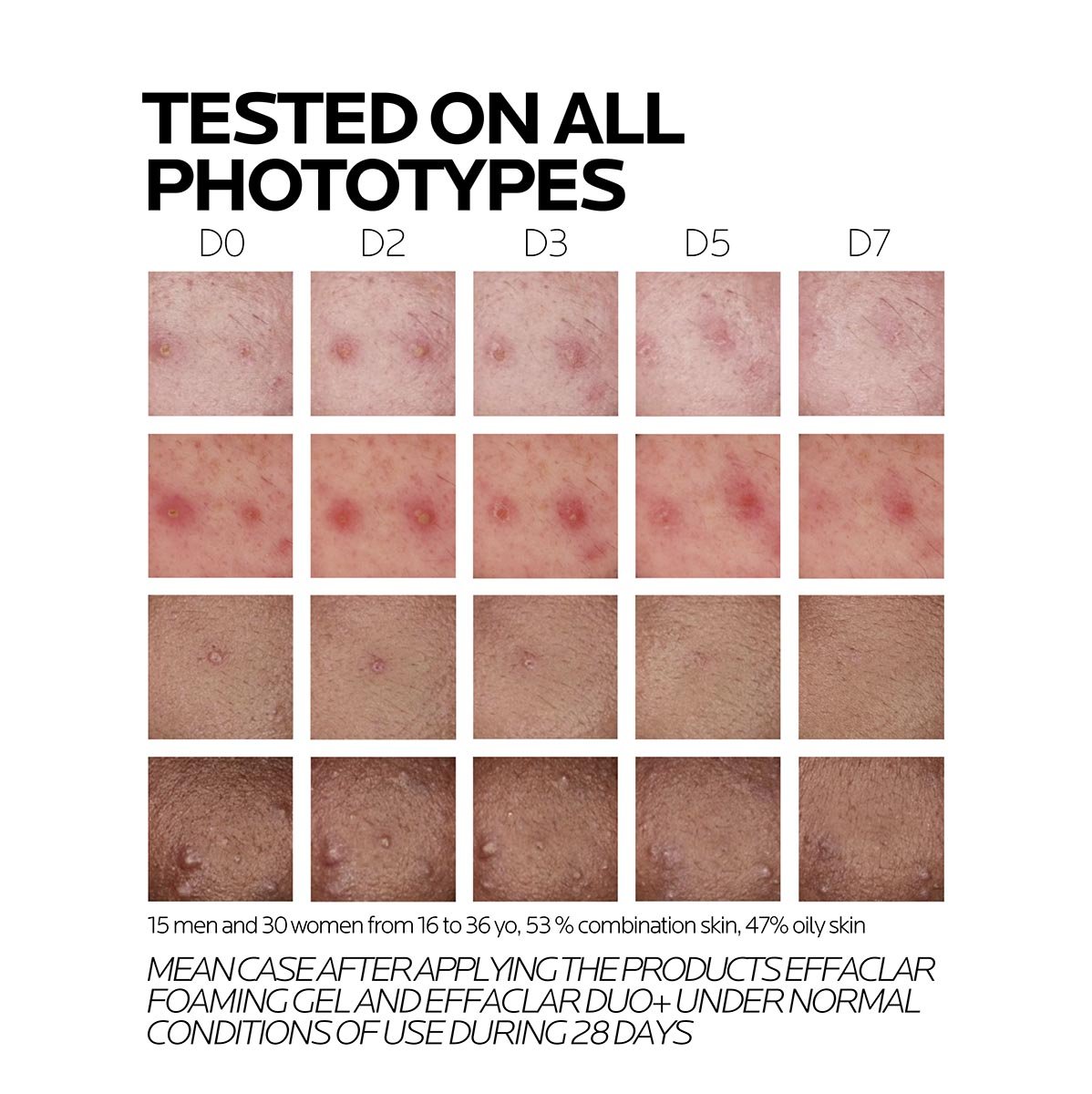 EFFACLAR DUO+M anti-imperfections triple corrective care